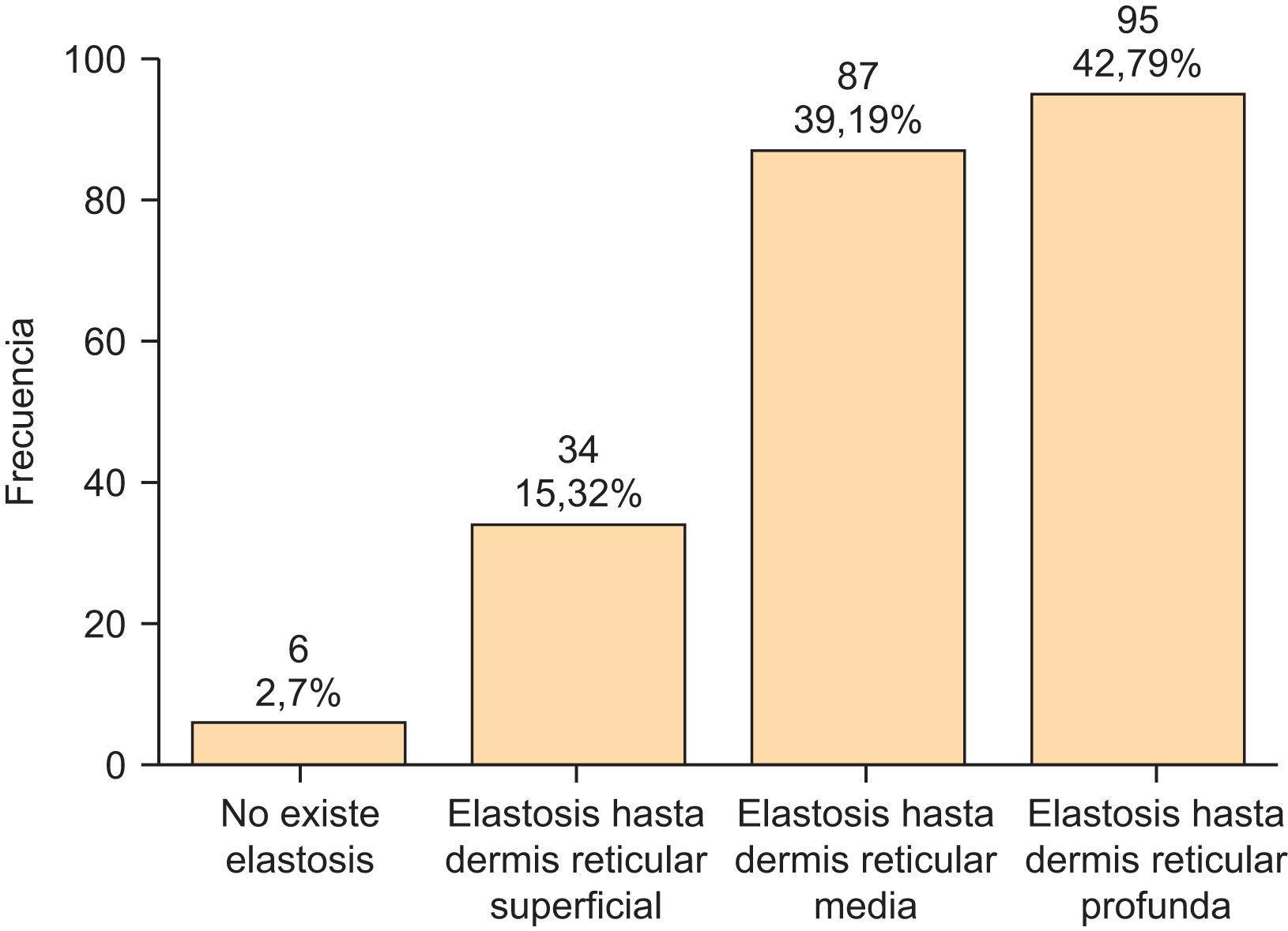 Elastosis solar en carcinomas espinocelulares cutáneos | Actas Dermo ...