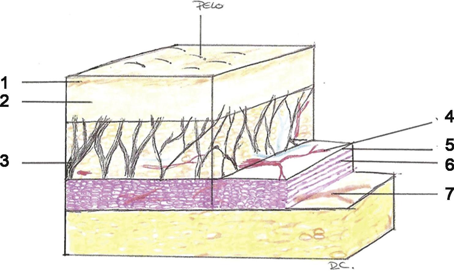 Planos quirúrgicos en cabeza y cuello | Actas Dermo-Sifiliográficas