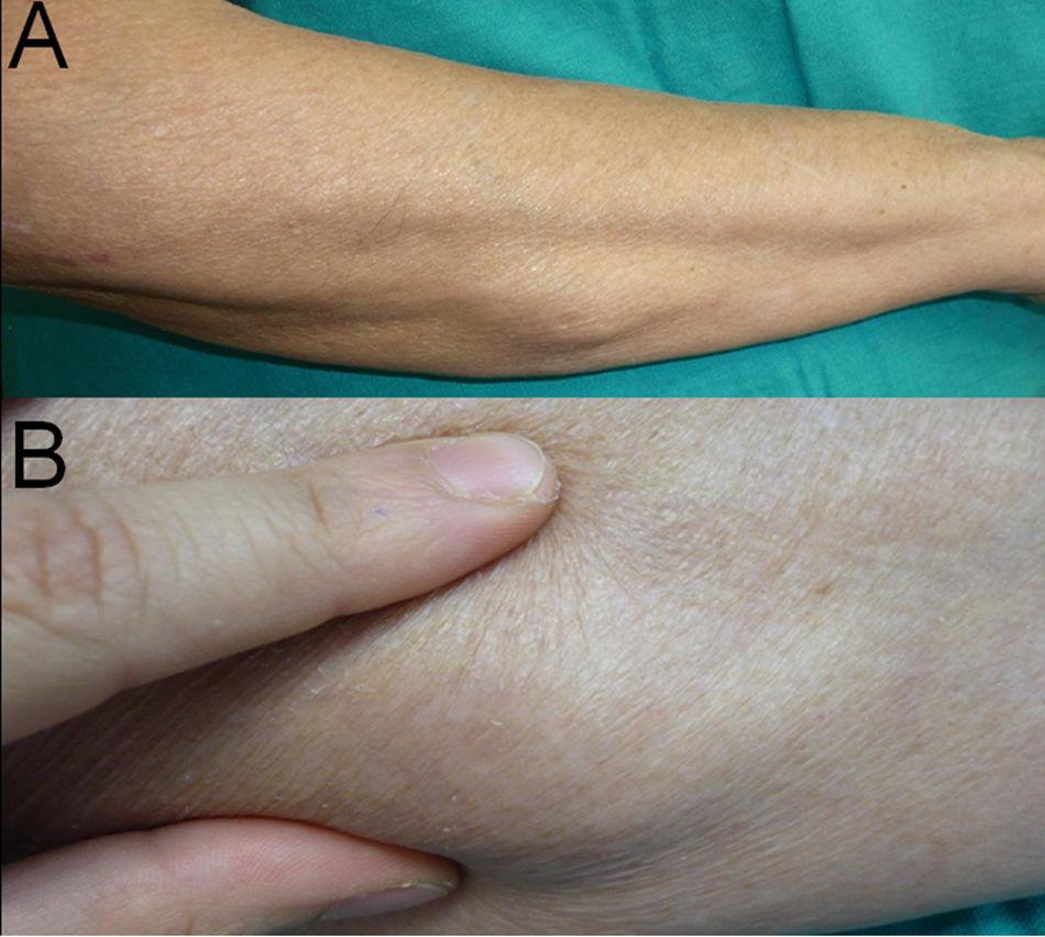 Nódulo 10mm Regular Definidos - RETOEDU