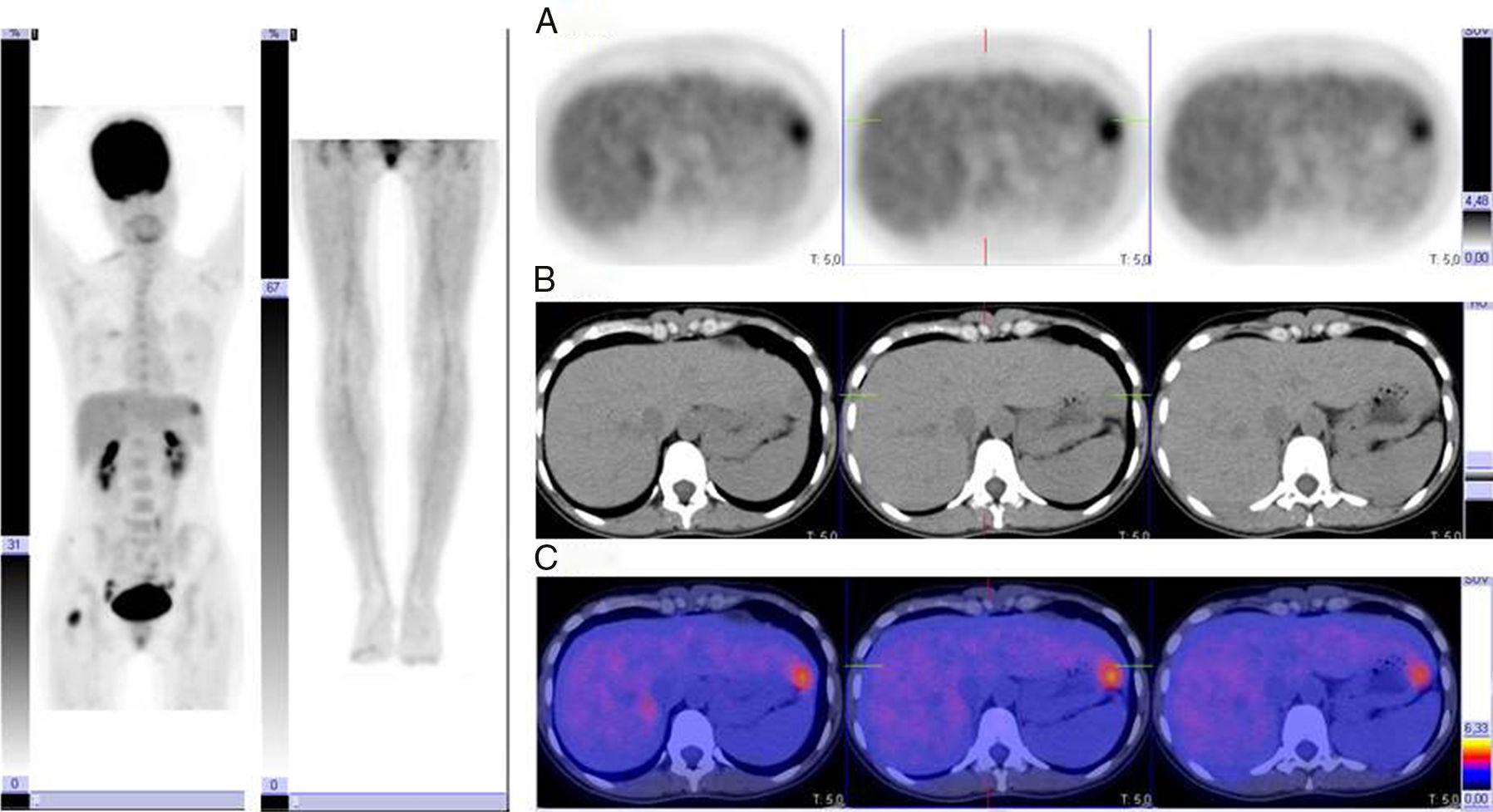 Diagnóstico por imagen en dermatología: utilidad de la tomografía por ...