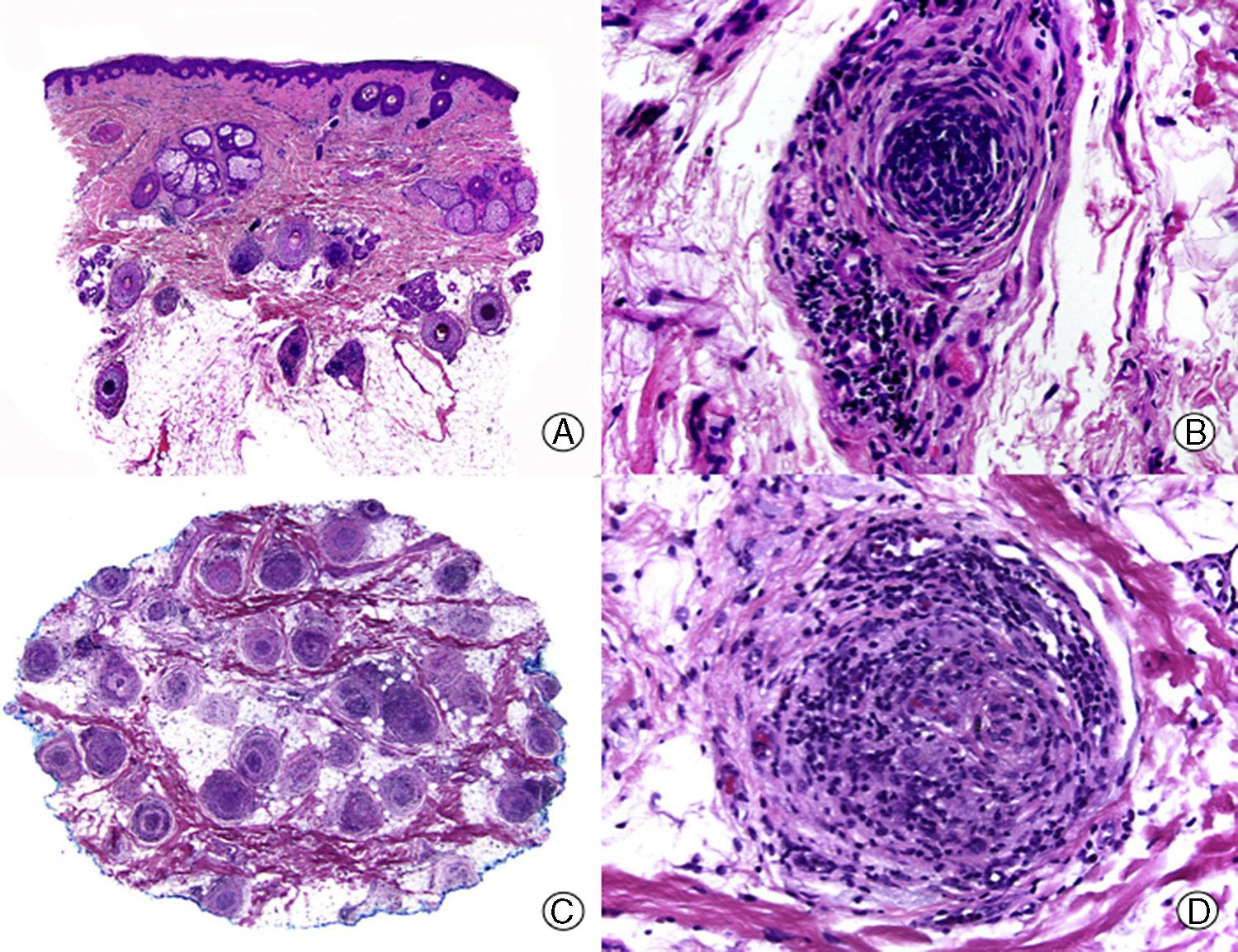 Histología Del Folículo Piloso