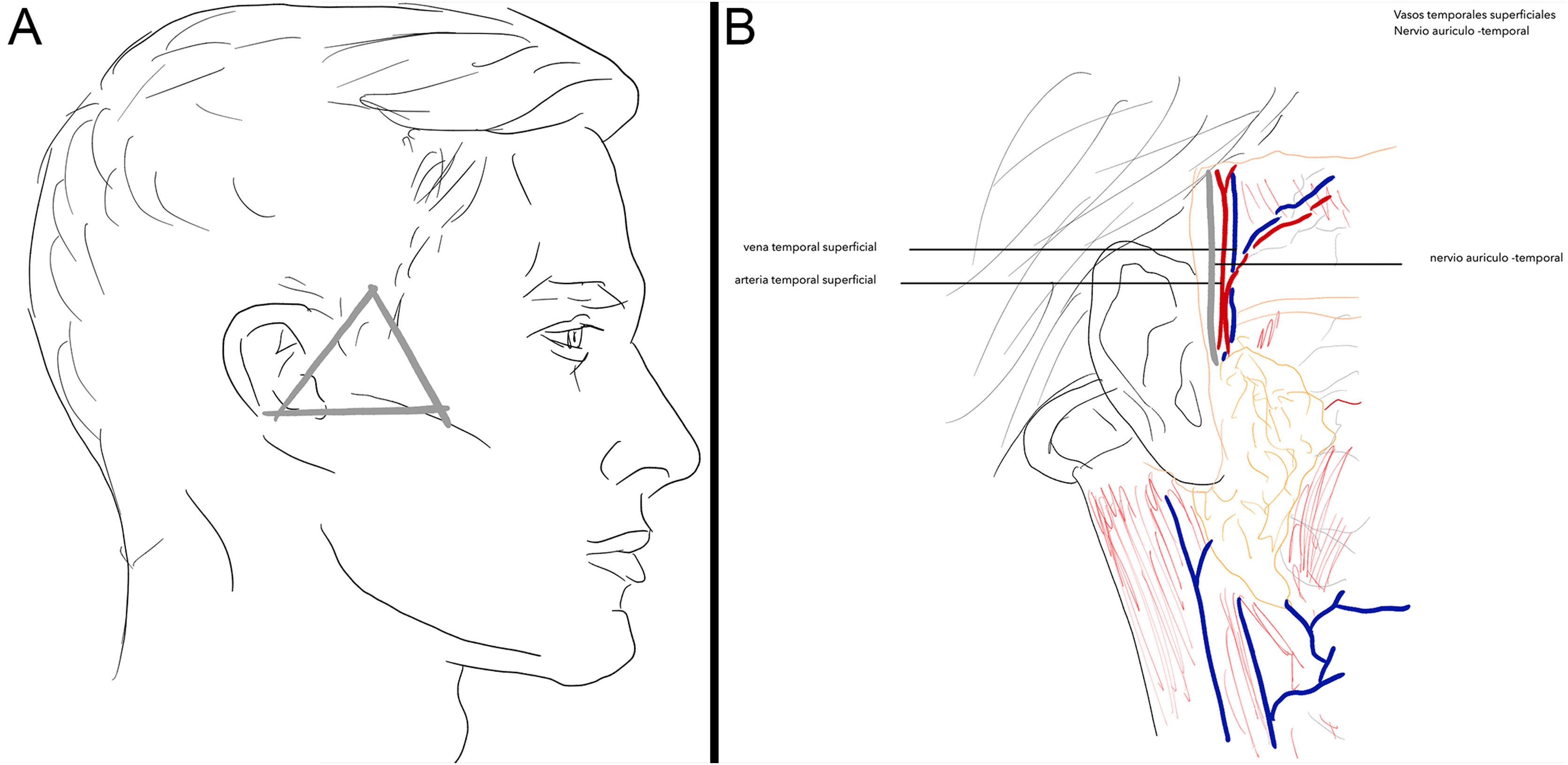 Seguridad en procedimientos dermatológicos: sección de grandes vasos ...
