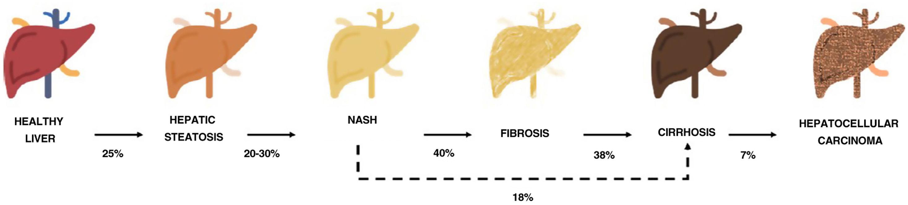 [Translated article] Common Approach to Metabolic-Associated Fatty ...