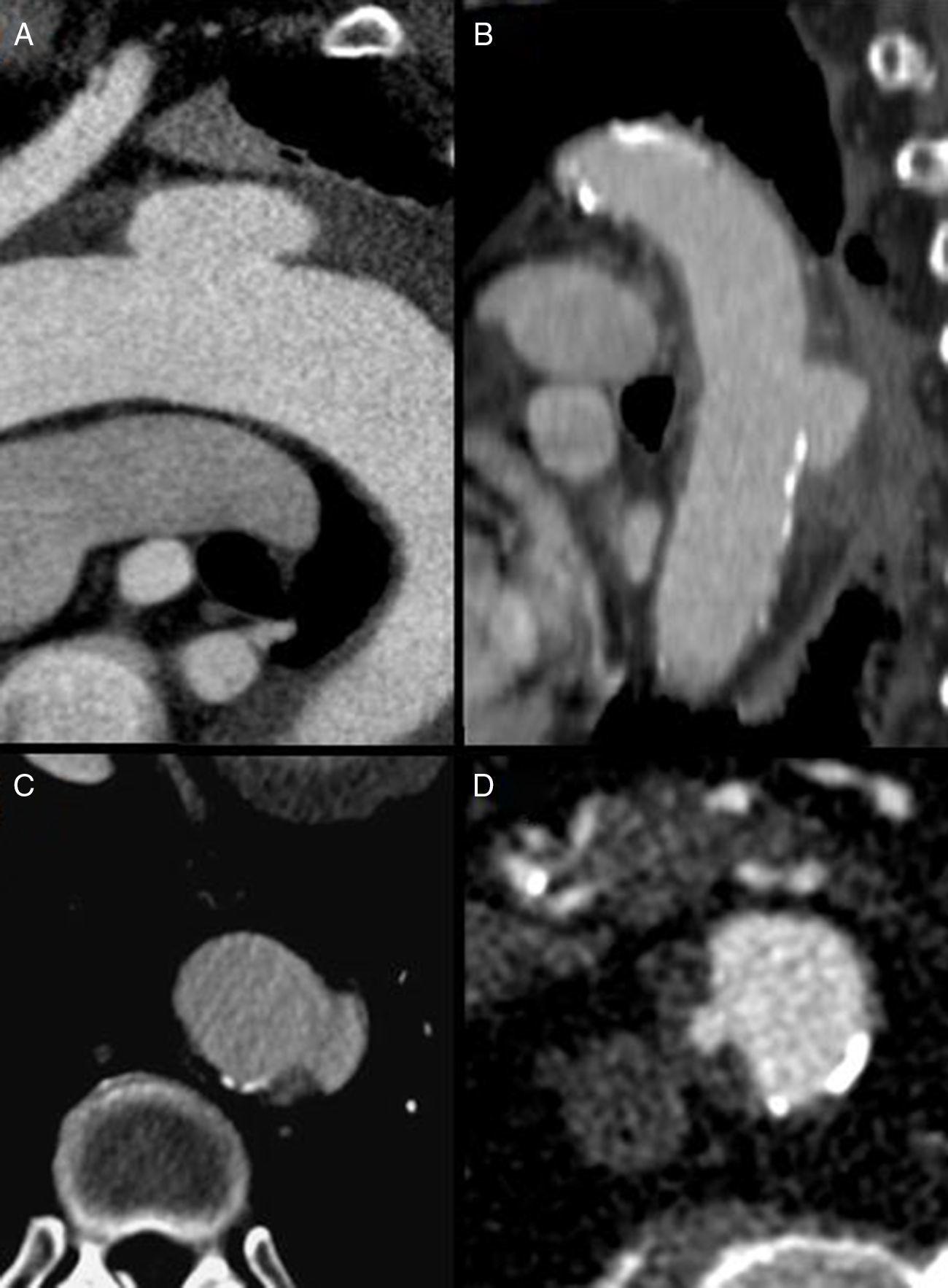 Actualización sobre las características pronósticas y el manejo ...