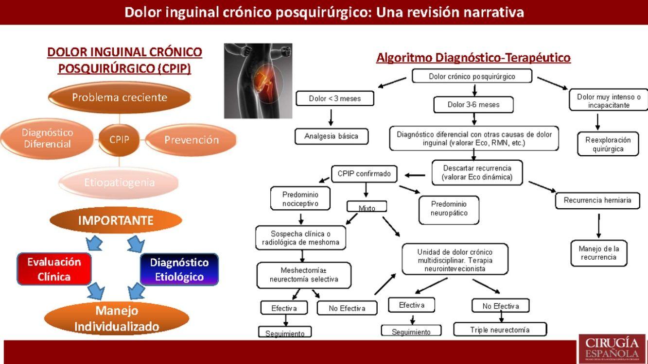 Dolor inguinal crónico posquirúrgico. Una revisión narrativa | Cirugía ...