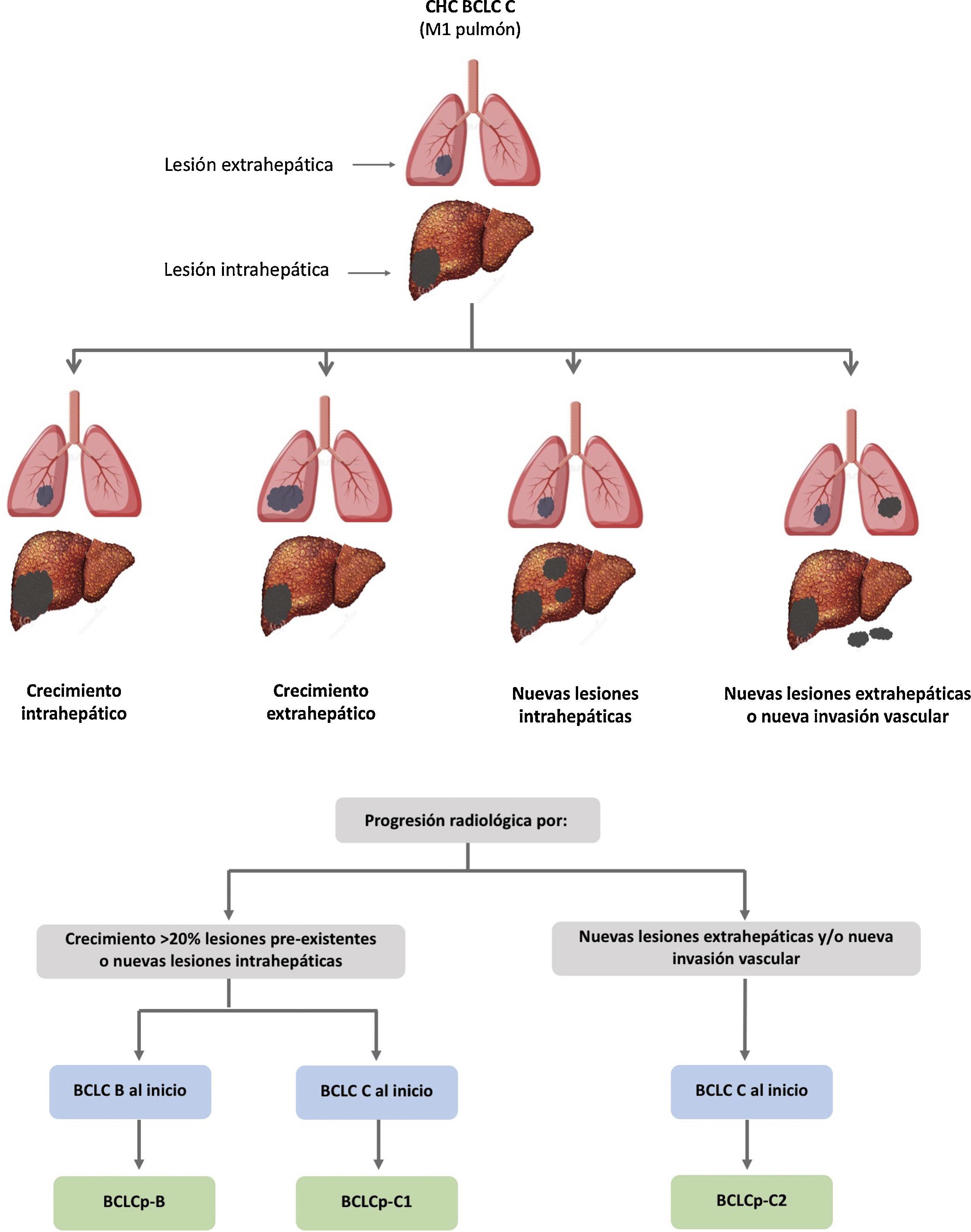 Diagnóstico y tratamiento del carcinoma hepatocelular. Actualización ...