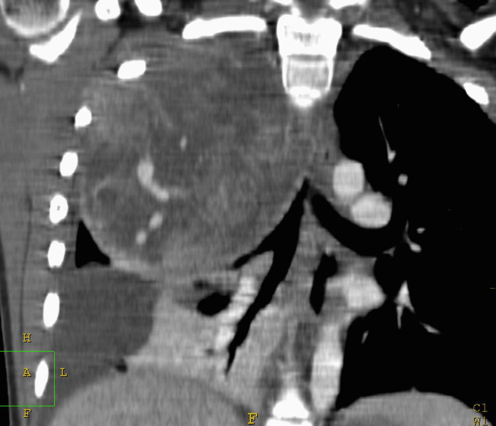 Caso 17 | Radiología