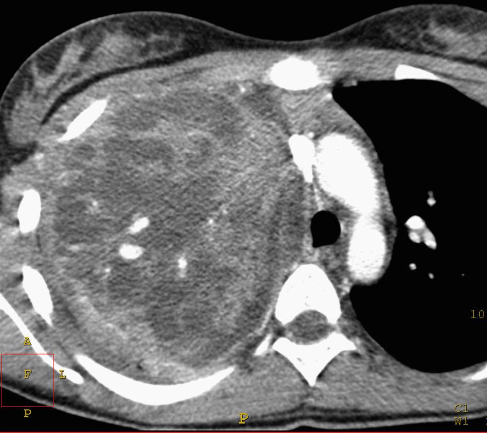 Caso 17 | Radiología