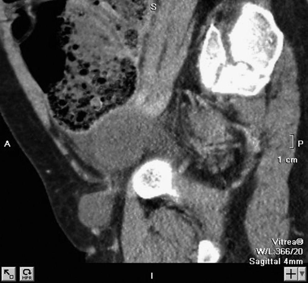 Caso 18 | Radiología