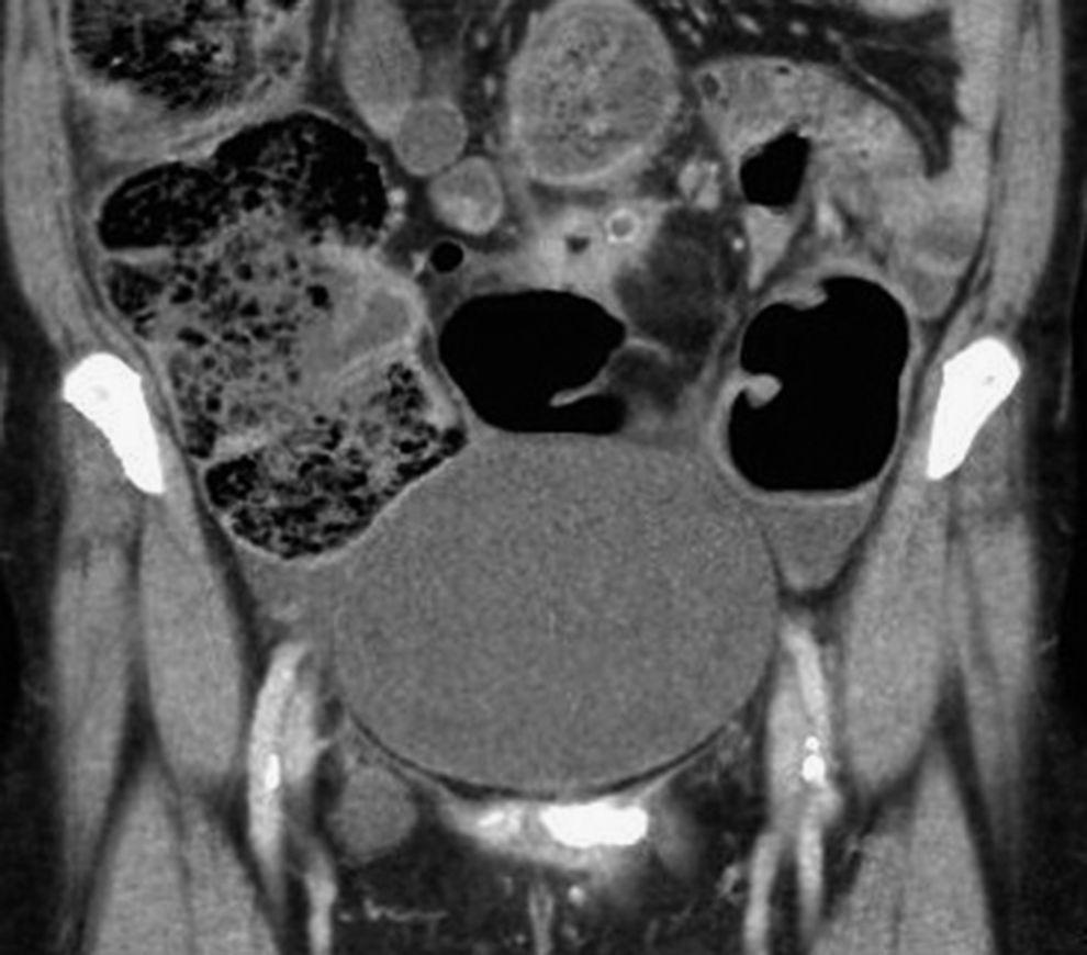 Caso 18 | Radiología