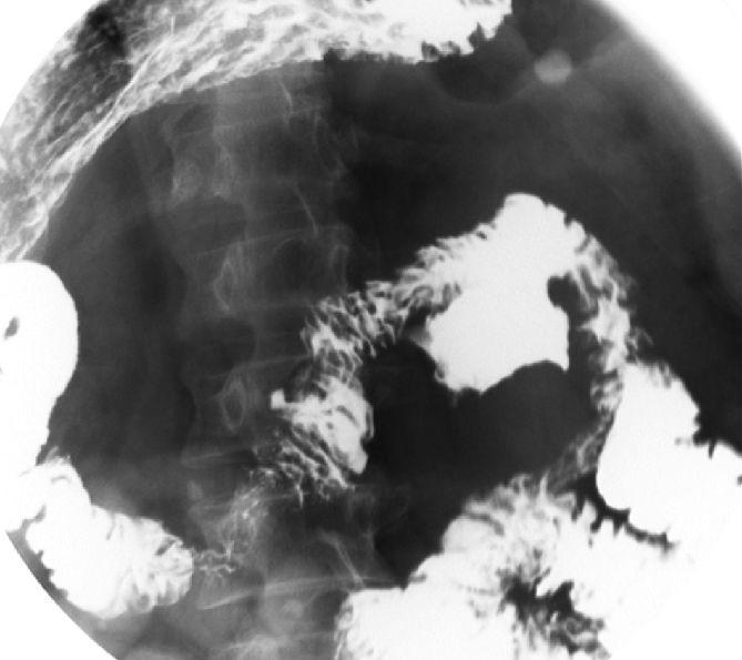 Caso 35 | Radiología