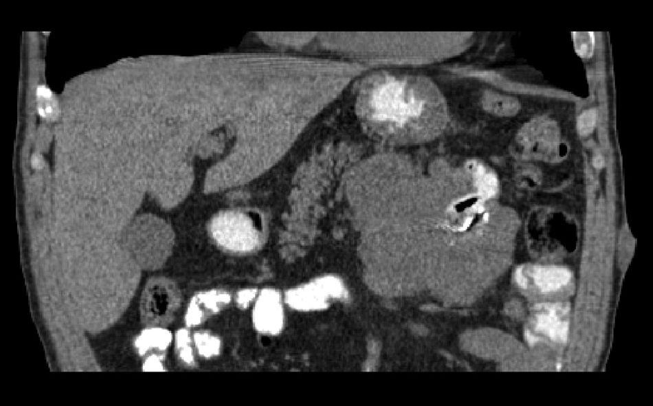 Caso 35 | Radiología