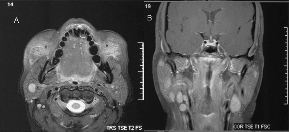Caso 42 | Radiología