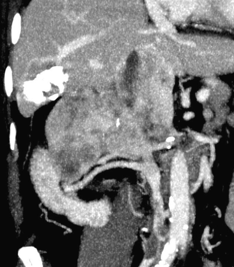 Caso 49 | Radiología
