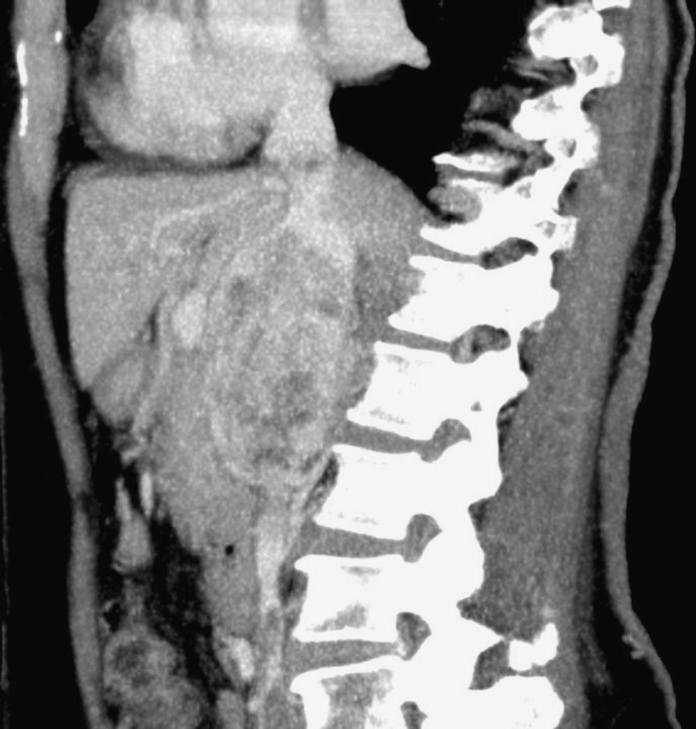 Caso 49 | Radiología