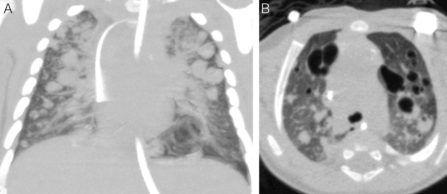Caso 51 | Radiología