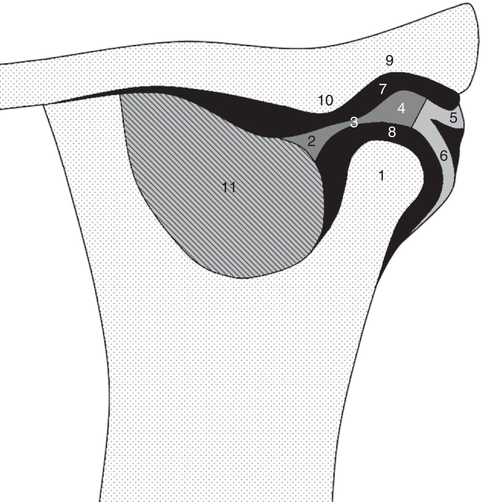 La articulación temporomandibular en la artritis idiopática juvenil: lo ...