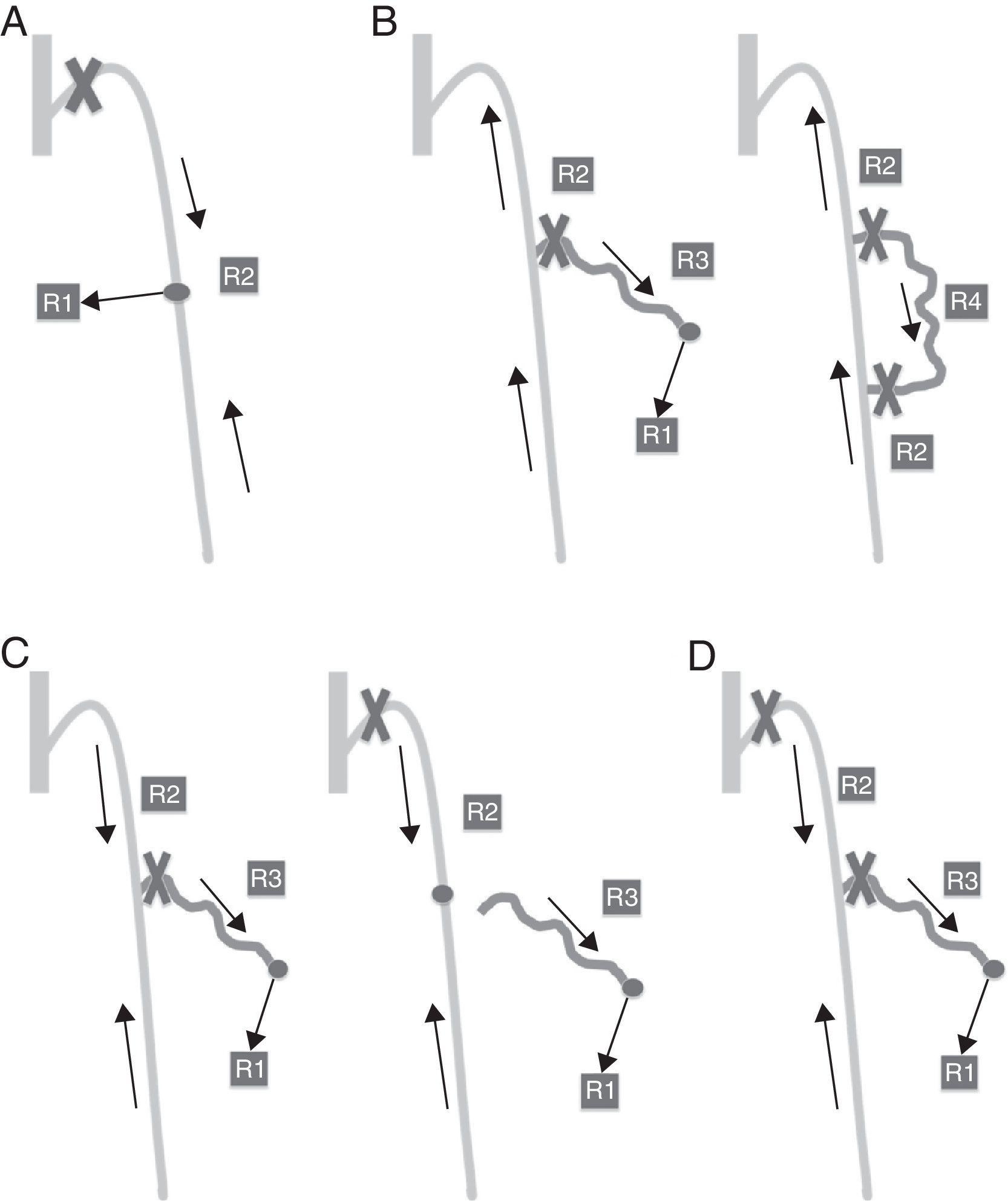 Estudio de la insuficiencia venosa crónica mediante ecografía Doppler y ...