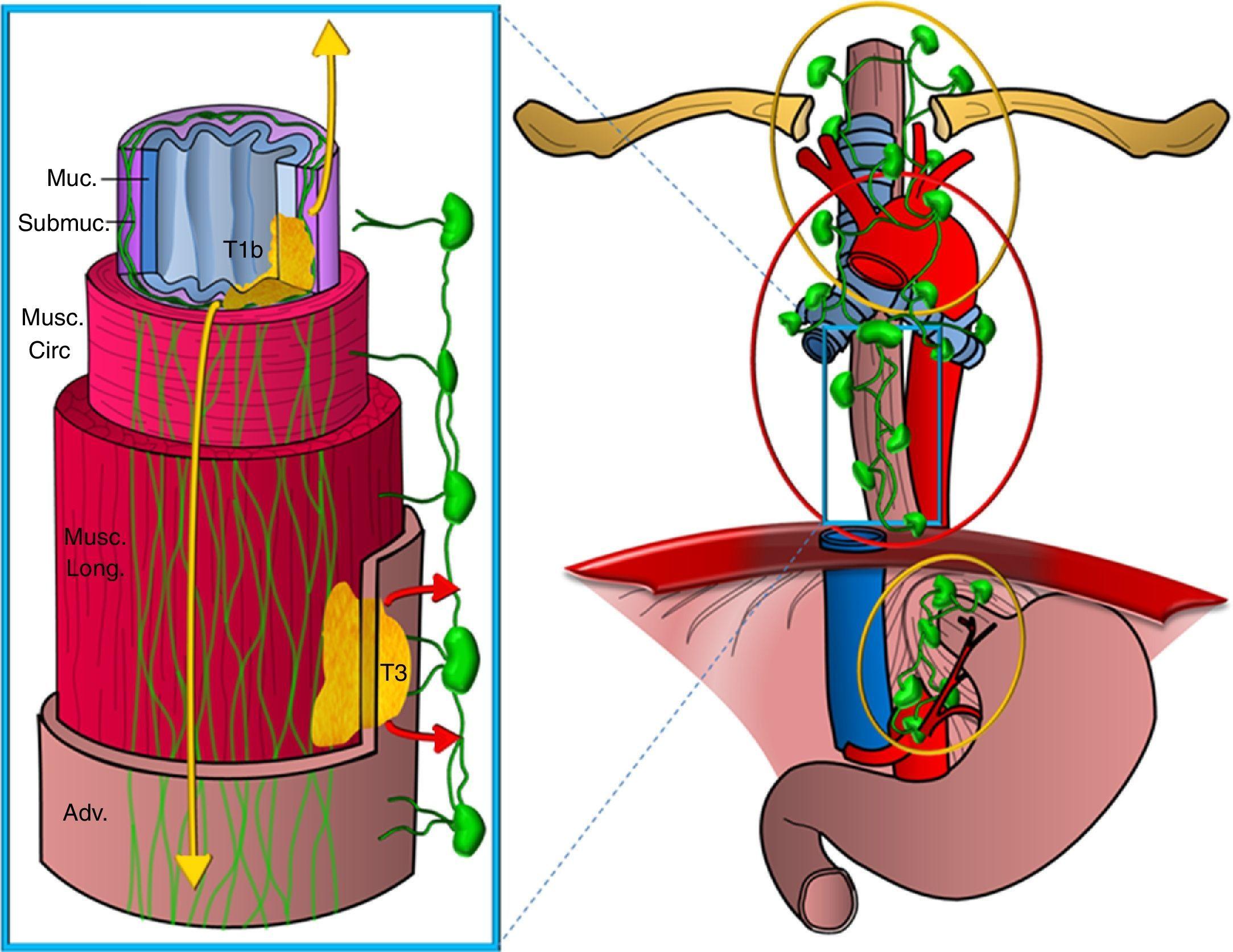 Cáncer de esófago: particularidades anatómicas, estadificación y ...