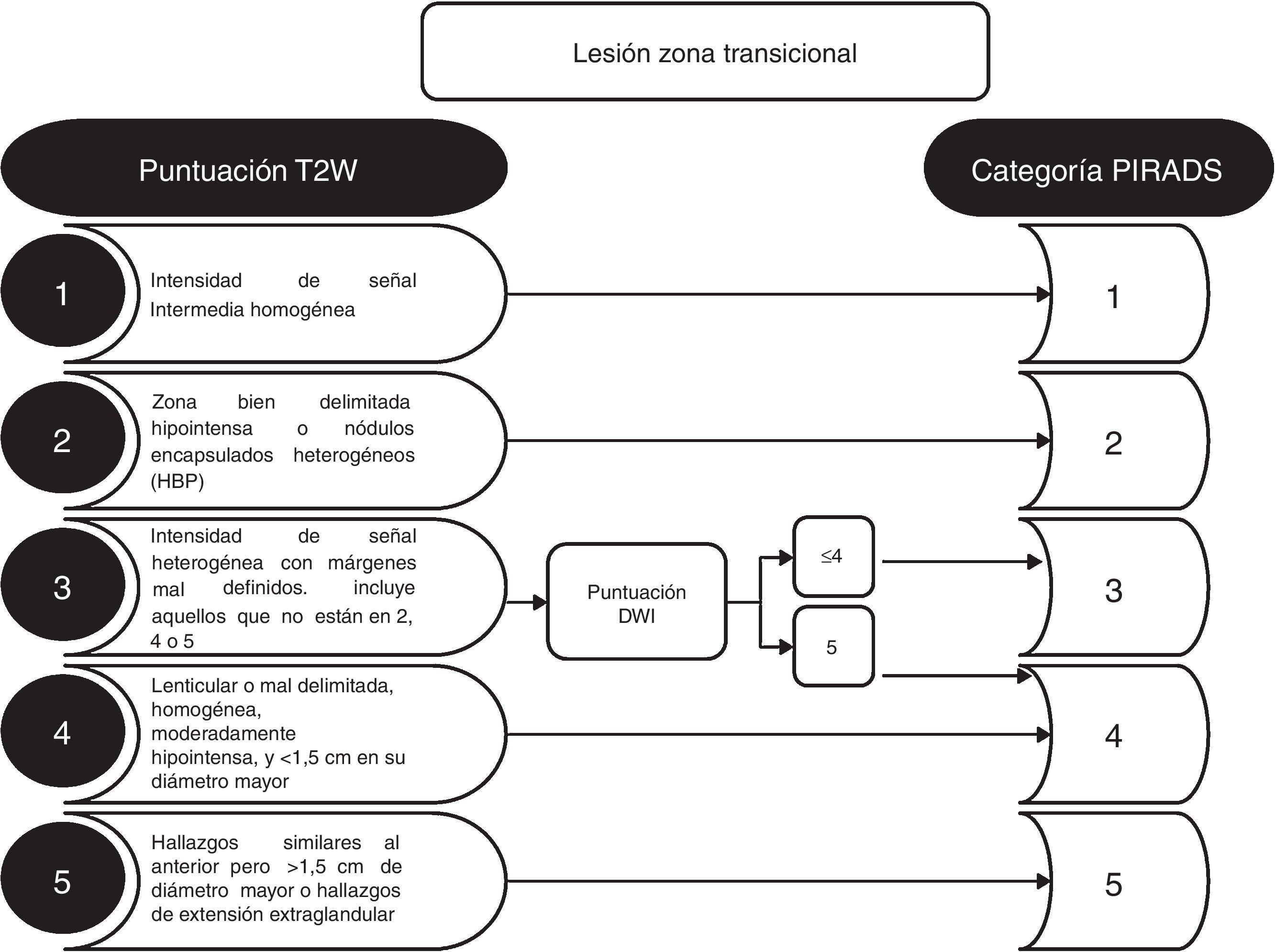 Resonancia magnética multiparamétrica y cáncer de próstata: ¿qué hay de ...