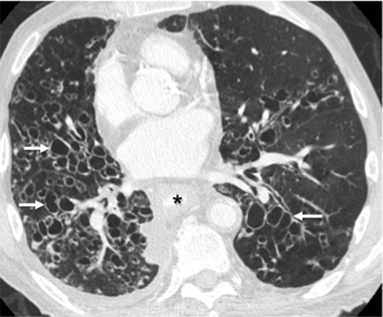 Papel de los estudios de imagen en el diagnóstico etiológico de las ...