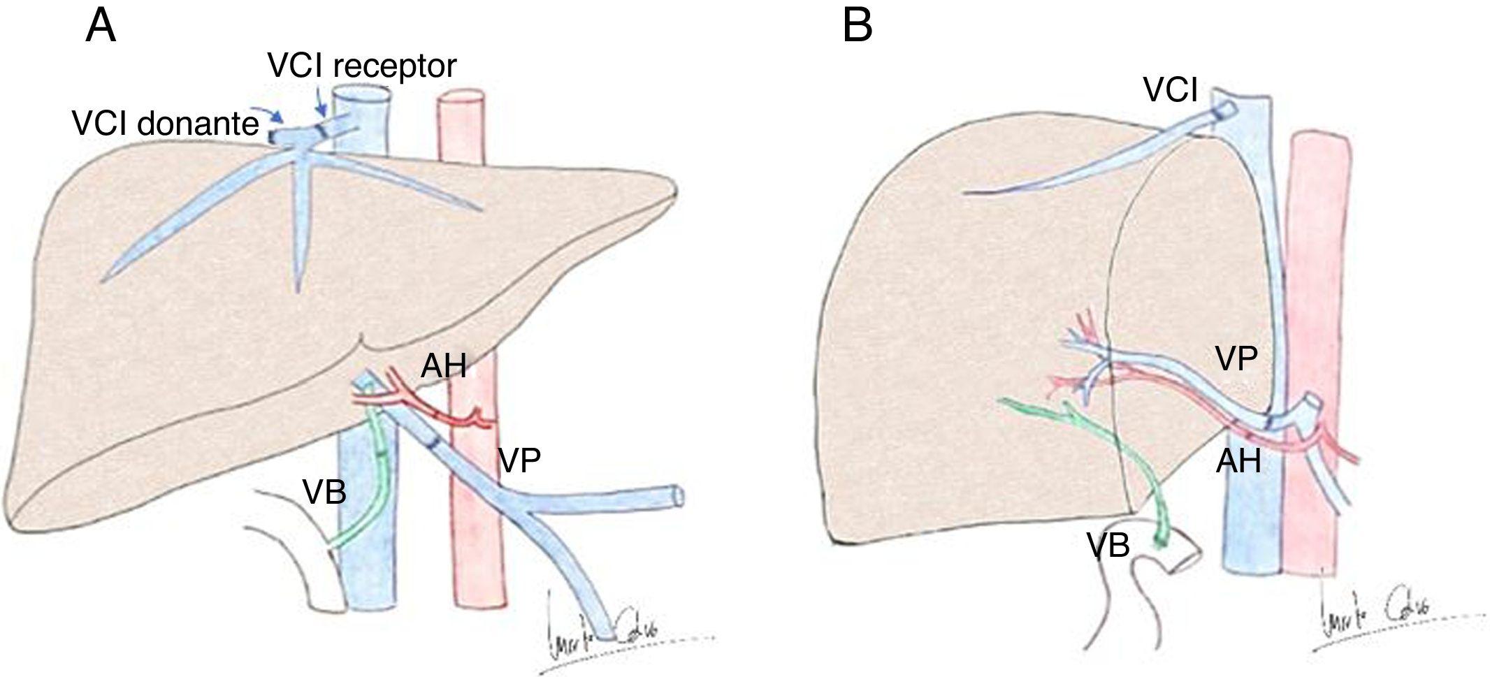 Hallazgos ecográficos transitorios y normales en el postoperatorio ...
