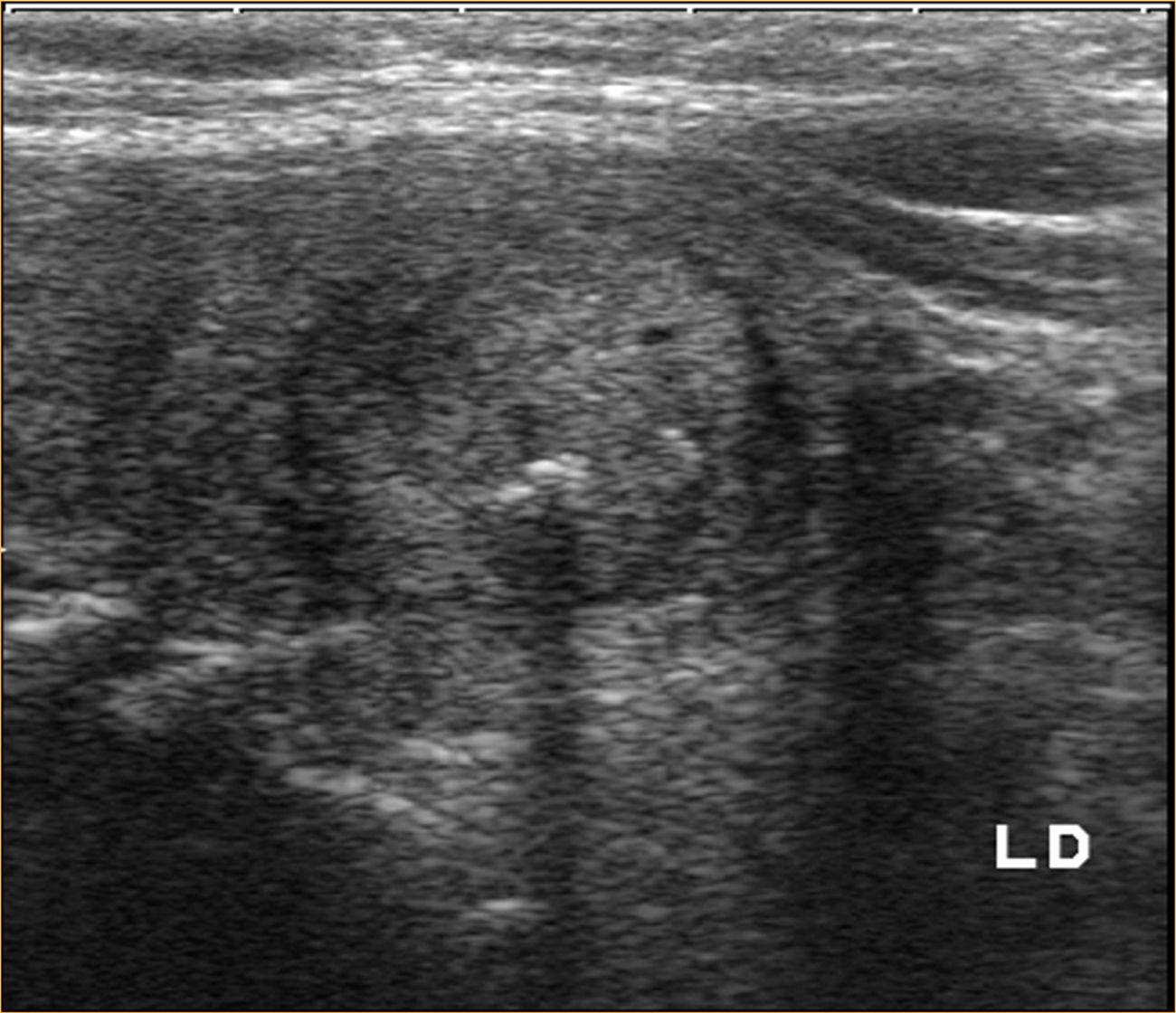 Un intento de reducir intervenciones quirúrgicas innecesarias ...