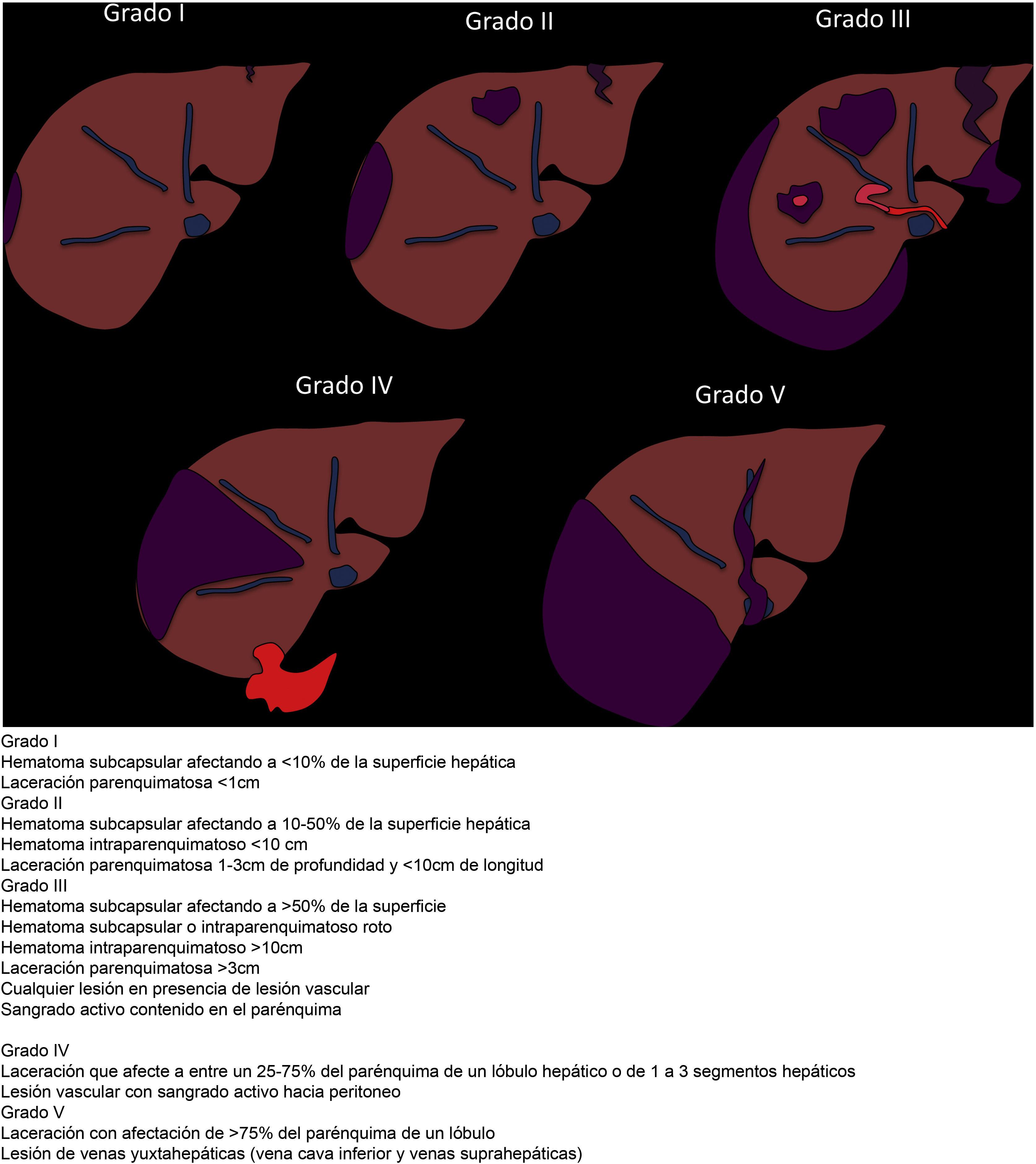 Traumatismo abdominal | Radiología