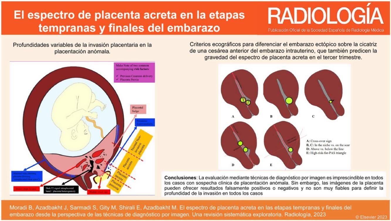 El espectro de placenta acreta en la etapa temprana y final del ...