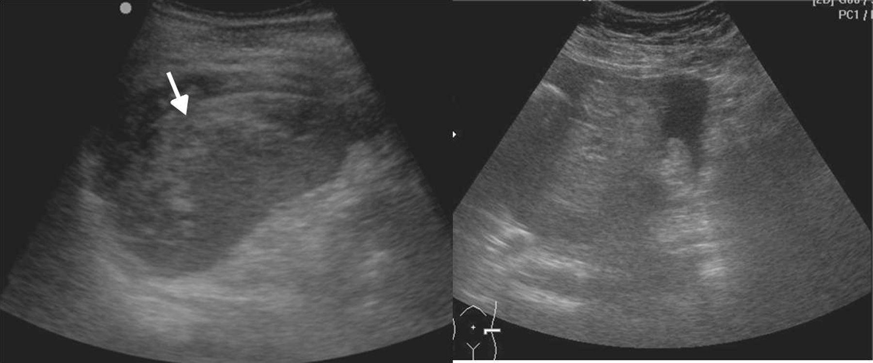 La ecografía primero: ¿Por qué, cómo y cuándo? | Revista Argentina de ...