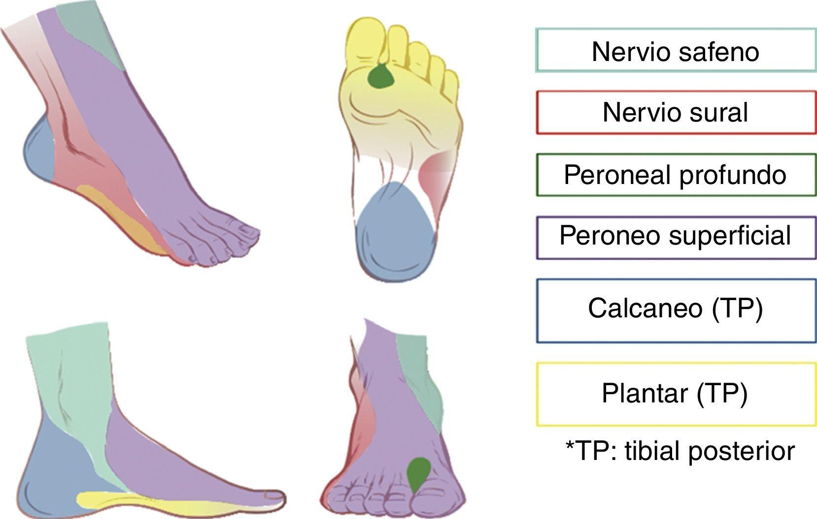 Bloqueo de tobillo guiado por ultrasonido: una técnica anestésica ...