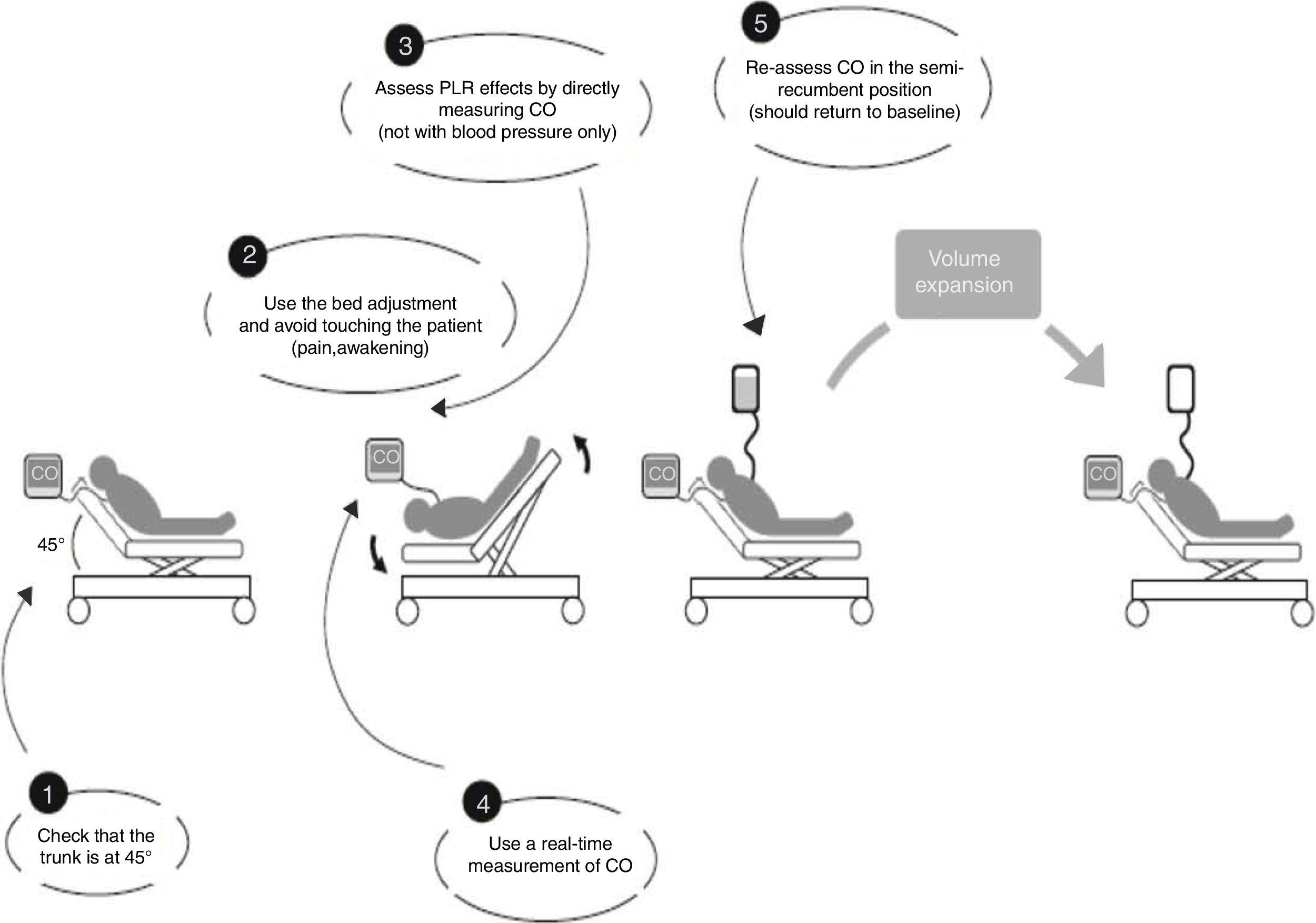 Ultrasound stroke volume variation induced by passive leg raising and ...