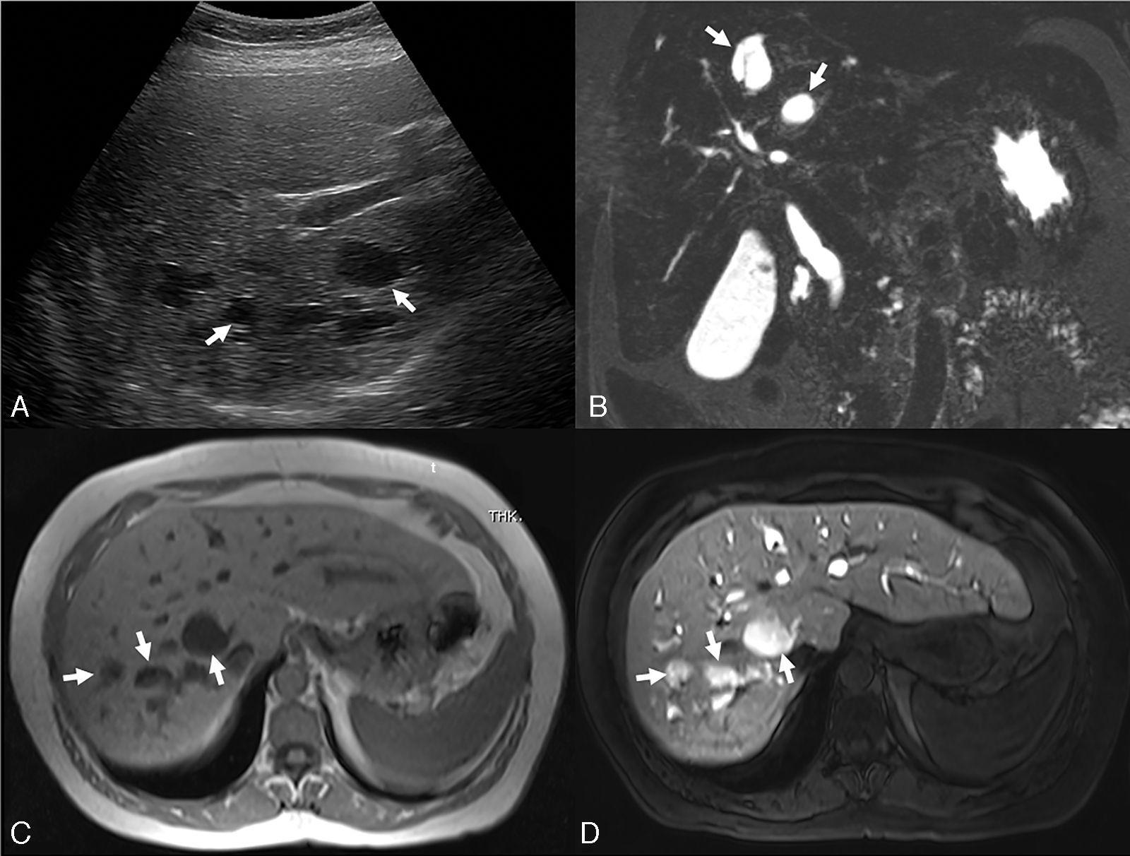 Contrast-enhanced magnetic resonance cholangiography with gadoxetic ...