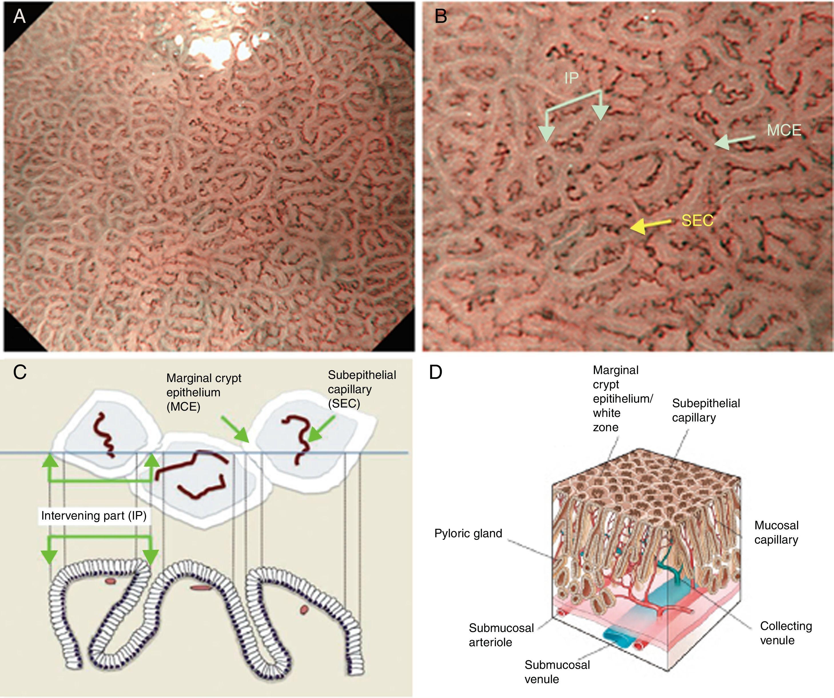 Endoscopic microanatomy of the normal gastrointestinal mucosa with ...