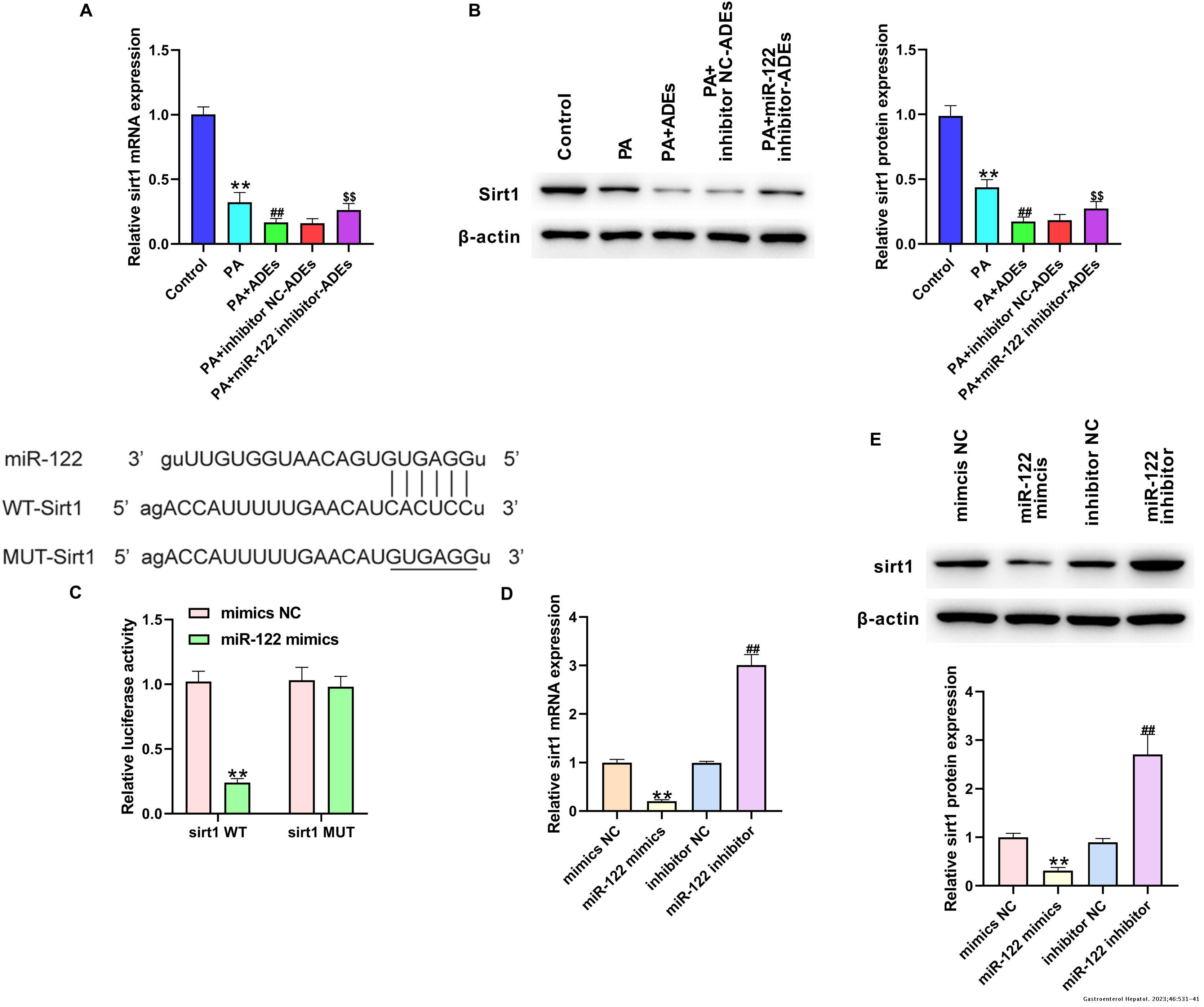 Adipocytes Derived Exosomal Mir 122 Promotes Non Alcoholic Fat Liver