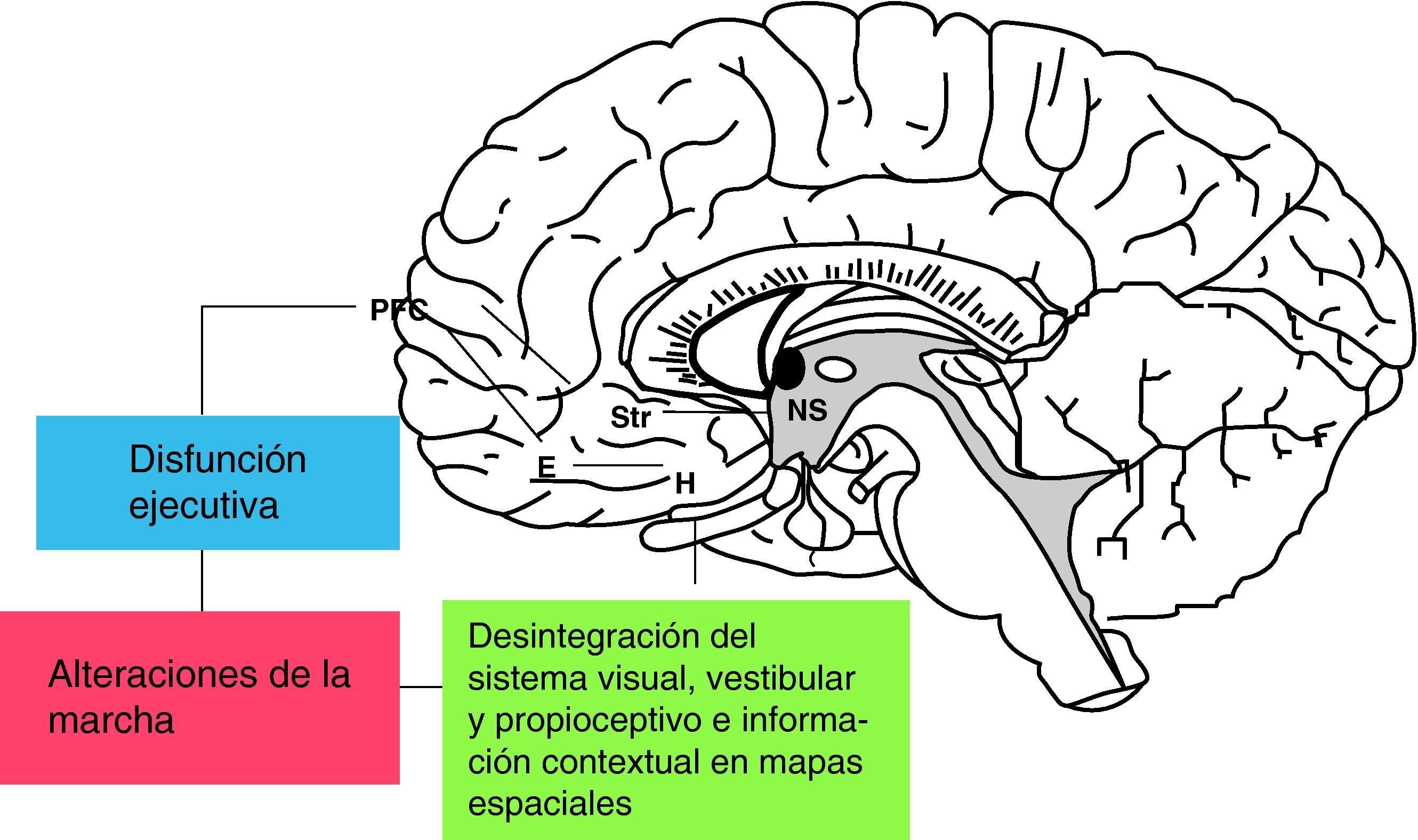Deterioro cognitivo y riesgo de caída en el anciano | Revista Española ...