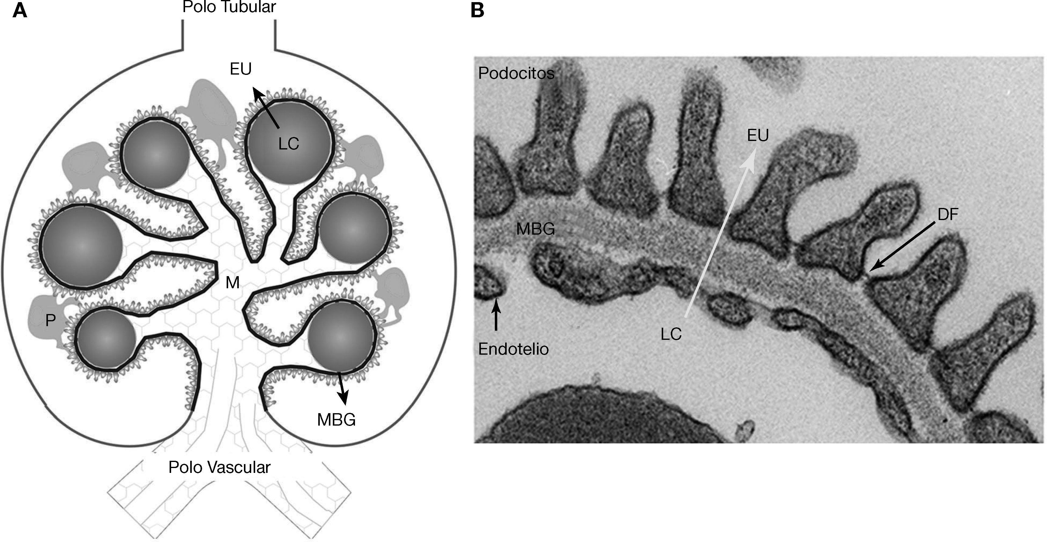 Aspectos celulares y moleculares de la nefropatía diabética, rol del ...