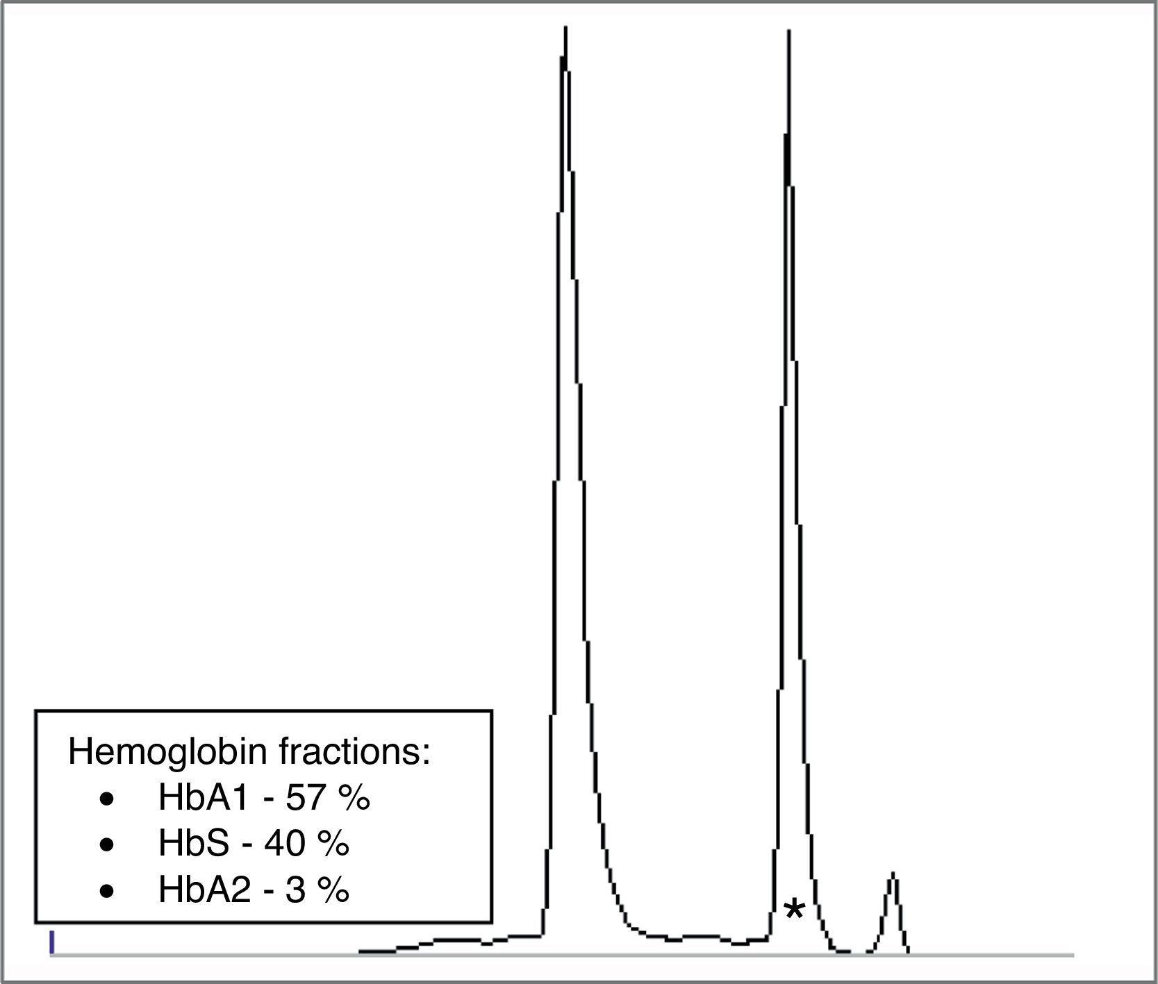 Hemoglobin Electrophoresis Cellulose Acetate