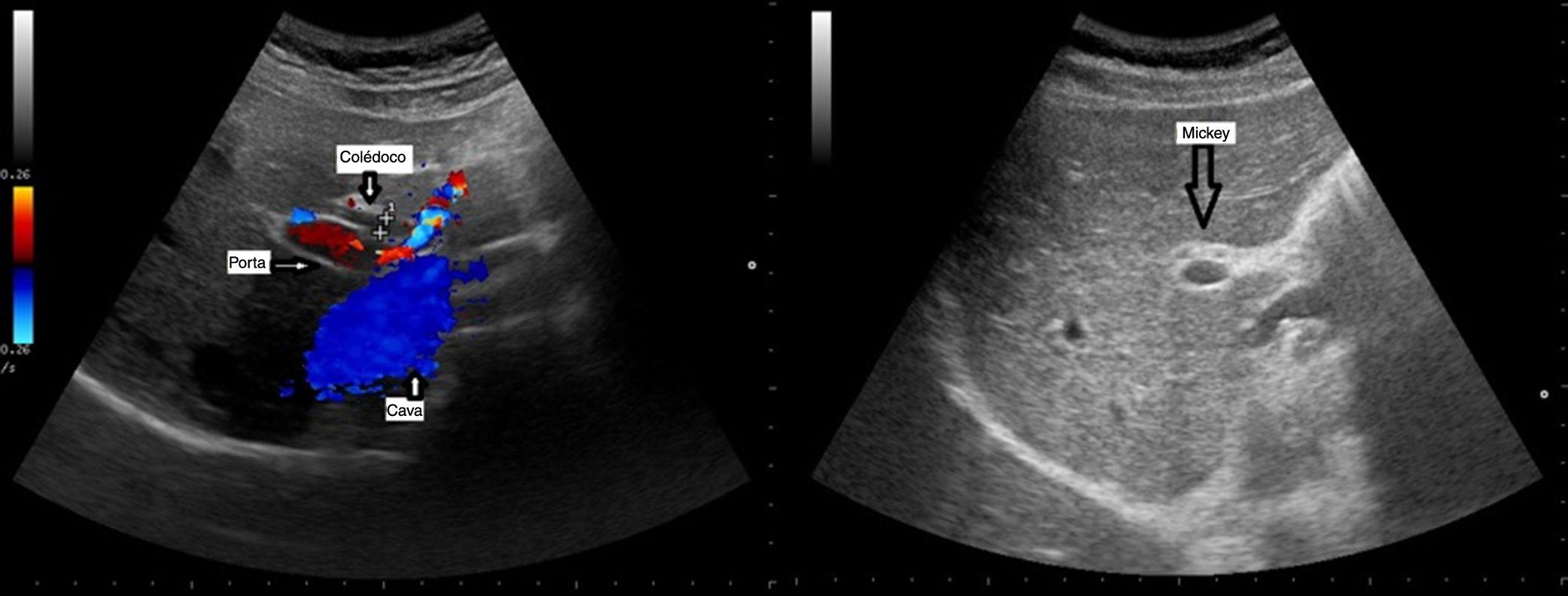 Utilidad y fiabilidad de la ecografía clínica abdominal en medicina ...