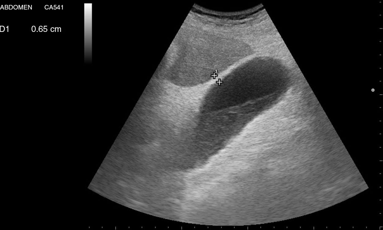 Utilidad y fiabilidad de la ecografía clínica abdominal en medicina ...
