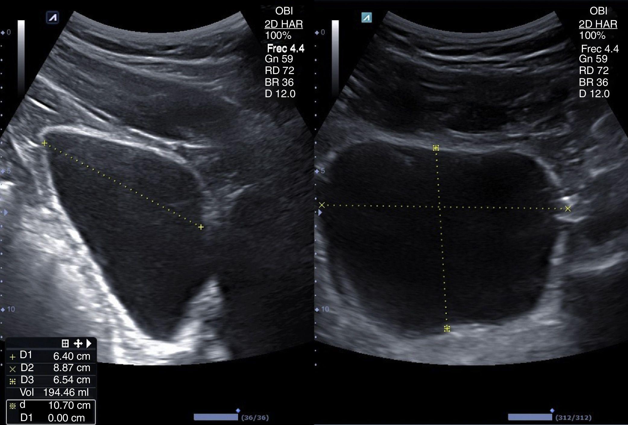 Utilidad y fiabilidad de la ecografía clínica abdominal en medicina ...
