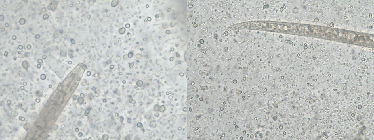 Larvae in a traveller's faeces. Not always what it seems | Enfermedades ...