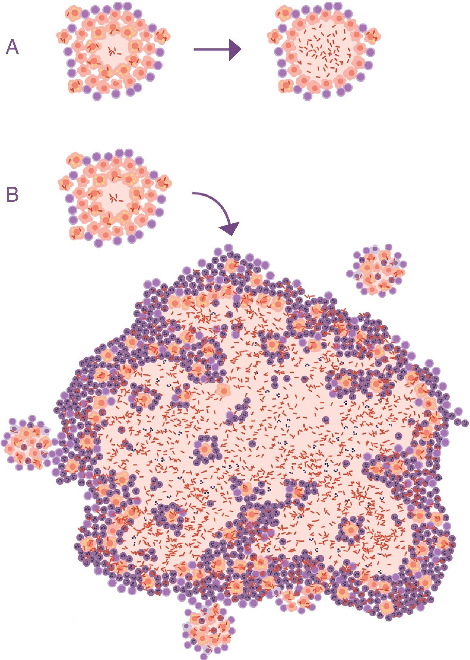 Patogénesis de la tuberculosis y otras micobacteriosis | Enfermedades ...