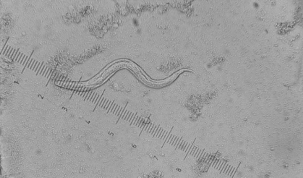 Diagnóstico de las infecciones por geohelmintos. Un problema sin ...