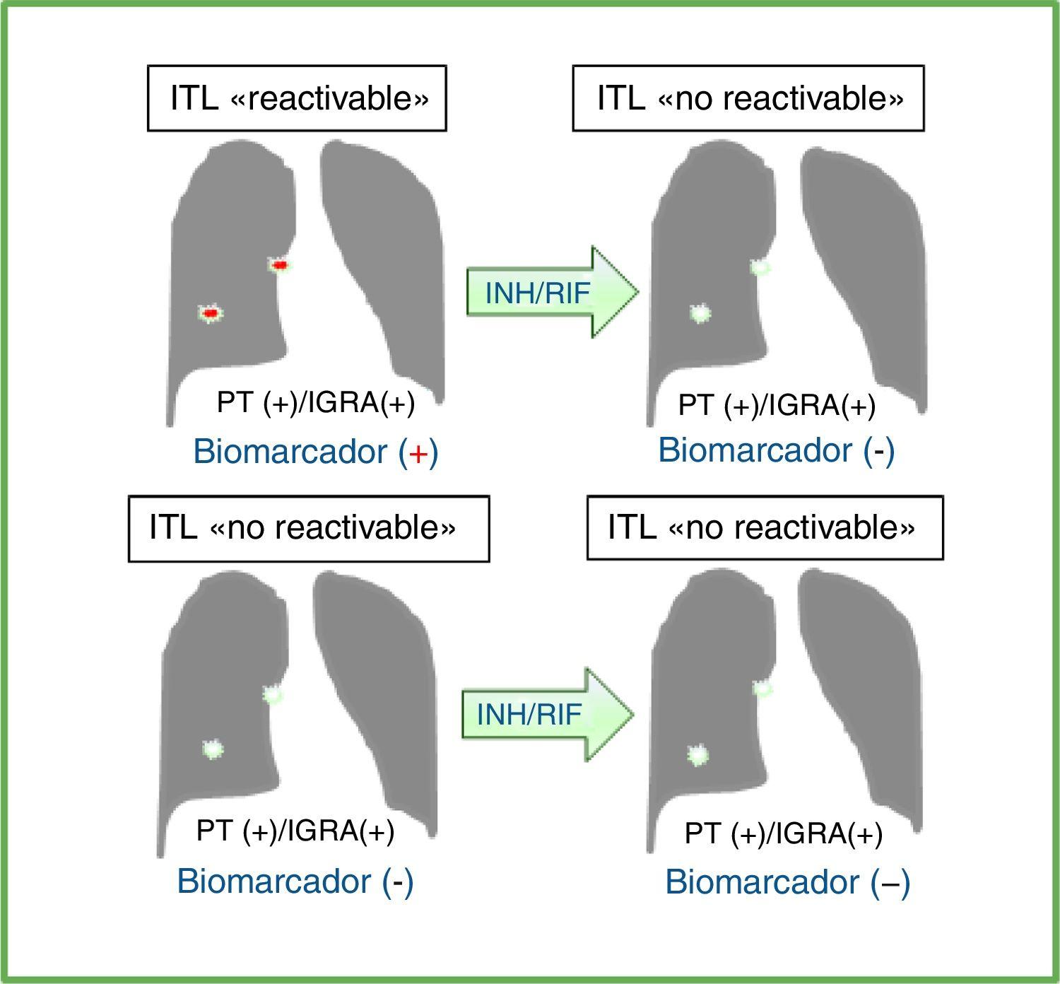 Nuevos enfoques en investigación de la infección tuberculosa latente ...