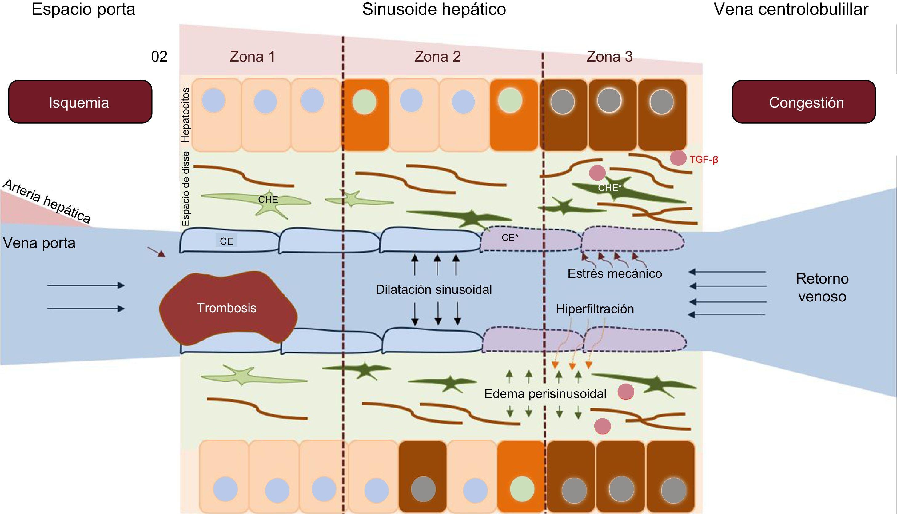 Enfermedad hepática crónica asociada con cirugía de Fontan | Revista ...