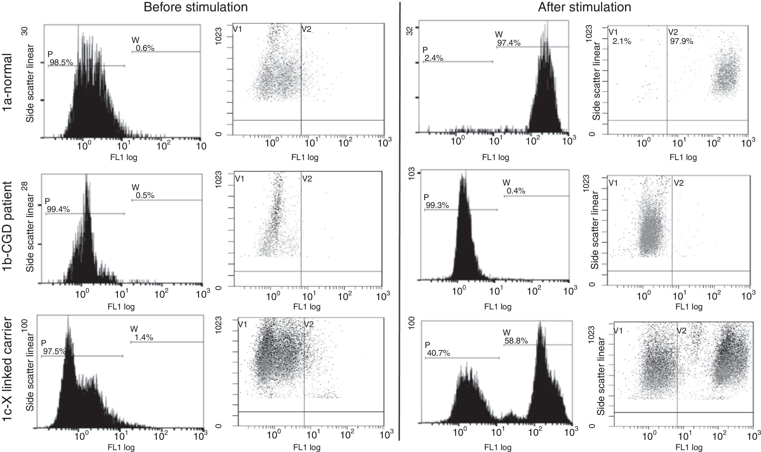 Chronic granulomatous disease: Review of a cohort of Egyptian patients ...