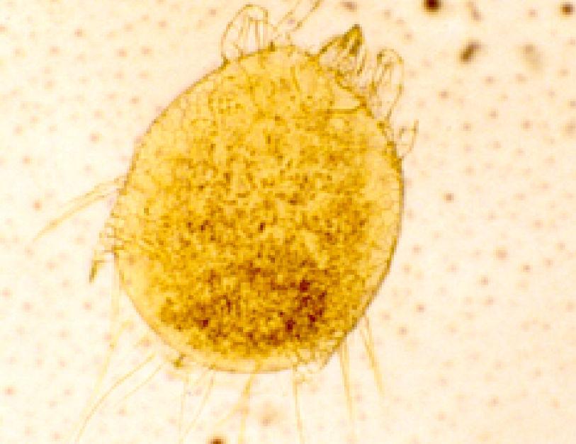 Algunos aspectos de la hipersensibilidad alérgica alimentaria a frutas ...