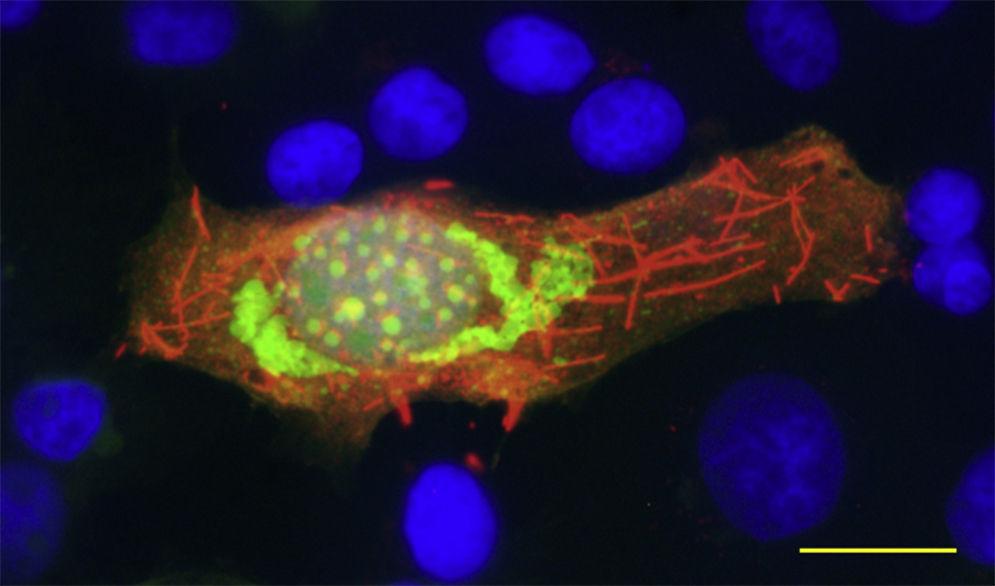 Rotavirus VP6 protein expressed in cell culture by HSV-1-based vectors ...