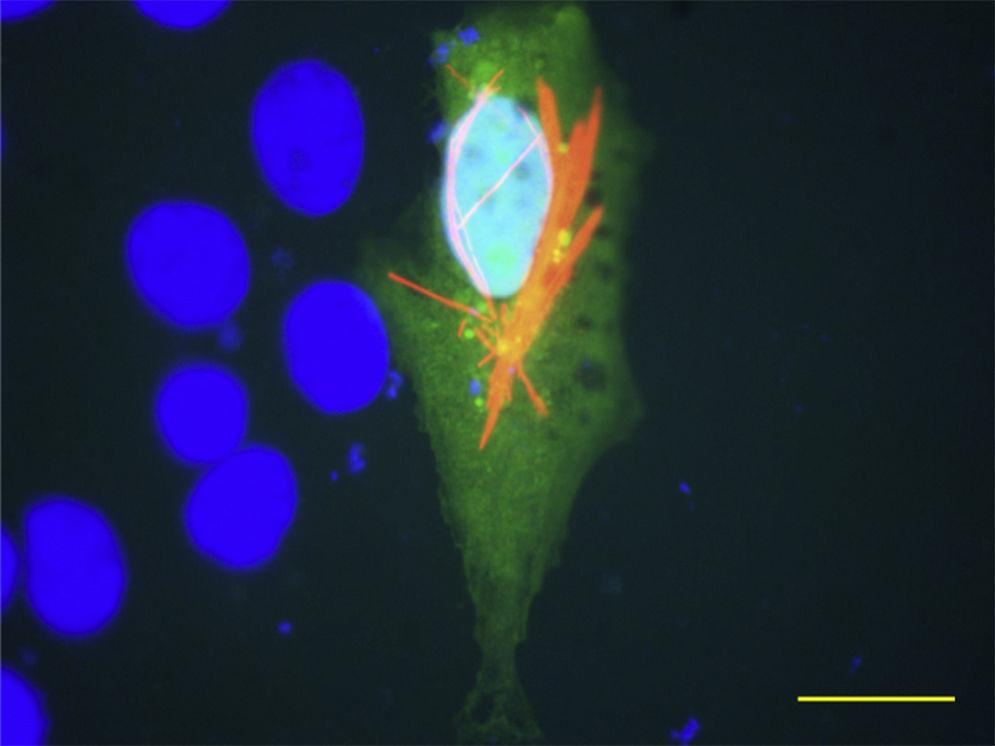 Rotavirus VP6 protein expressed in cell culture by HSV-1-based vectors ...